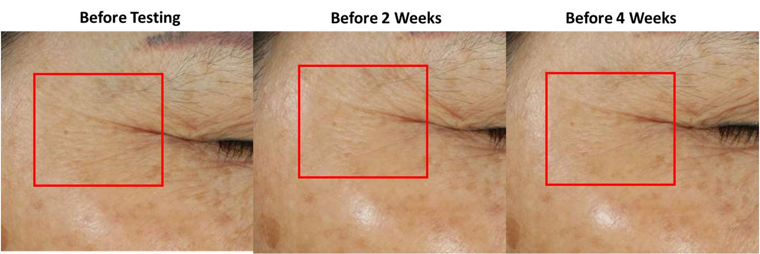 The Next Generation Peptide for Instant Wrinkle Reduction | BGT