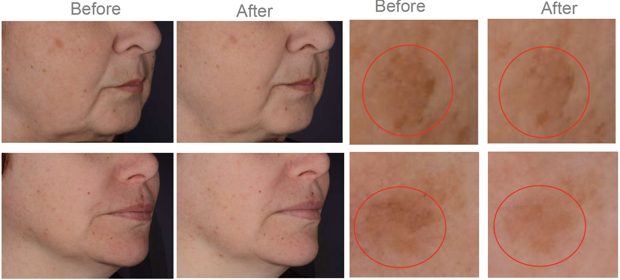 Defending Against Pollution-Induced Skin Damage | Natura-Tec